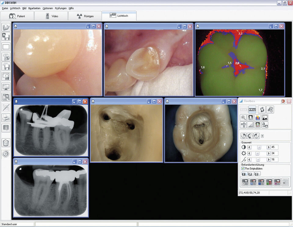 Visualization software - DBSWIN - Dürr Dental - diagnostic / planning / design