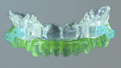 Anti-snoring mouthpiece - Silensor-sl - ERKODENT Erich Kopp