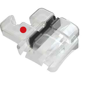 Resin Brackets Orthodontics Braces Generic Dental Model With Braces
