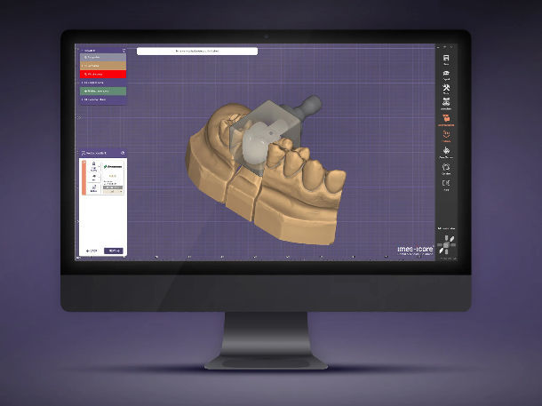 CAD software - iCAM one - imes-icore GmbH - dental / dental