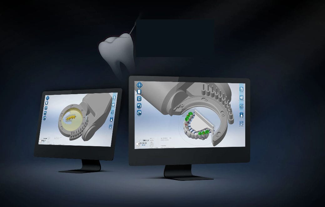 Analysis software - iCAM V5 - imes-icore GmbH - for dental implantology