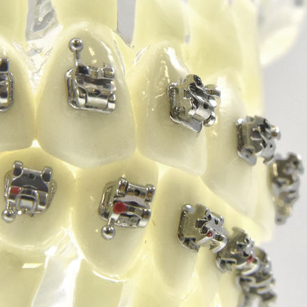 Self-ligating orthodontic bracket - InterActive SL - LEONE S.p.a. - low ...