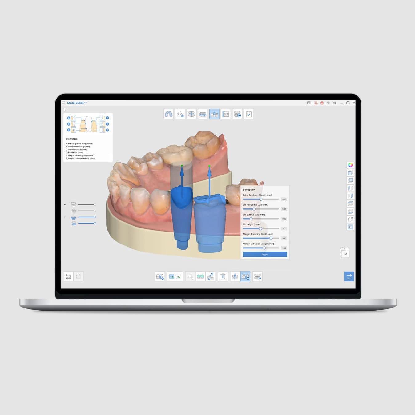 Scan web application - Medit - modeling / 3D printing / dental