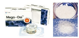 Allograft bone substitute / orthopedic surgery / rigid - Mega - Oss ...