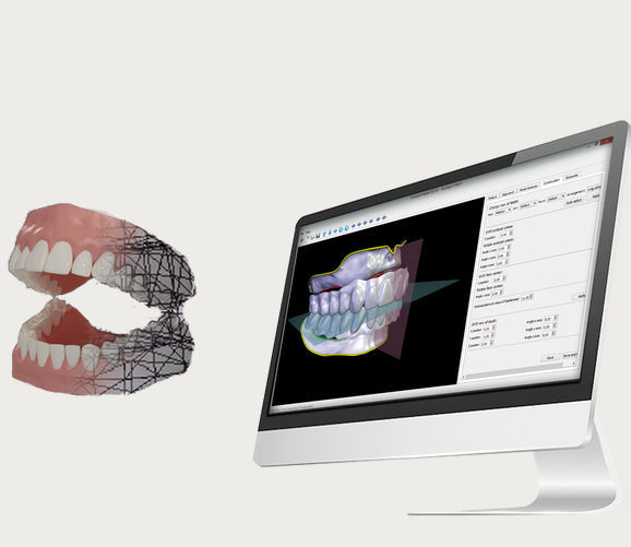 Dental prosthesis design software - BDCreator - Merz Dental GmbH - for ...