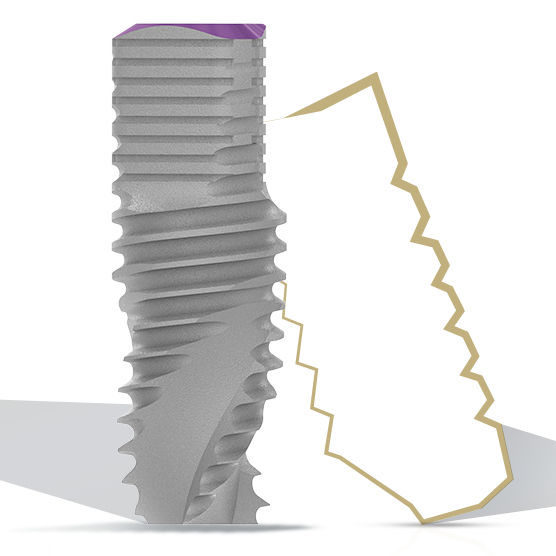 Cylindrical dental implant - V3 - MIS Implants Technologies Ltd ...
