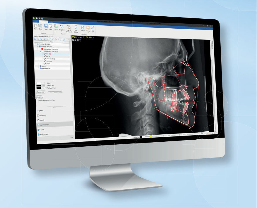 Dental software module - CephAnalysis - Owandy Radiology - cephalometric analysis / planning ...
