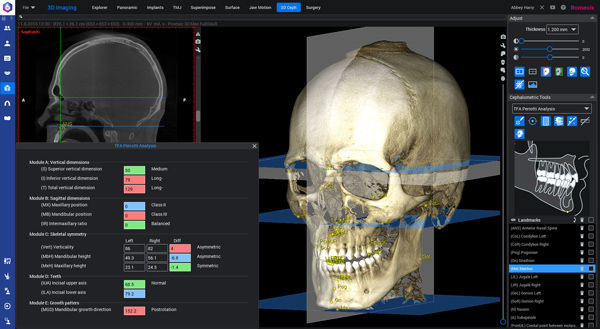 Cephalometric analysis software - Romexis® - Planmeca - 3D viewing ...