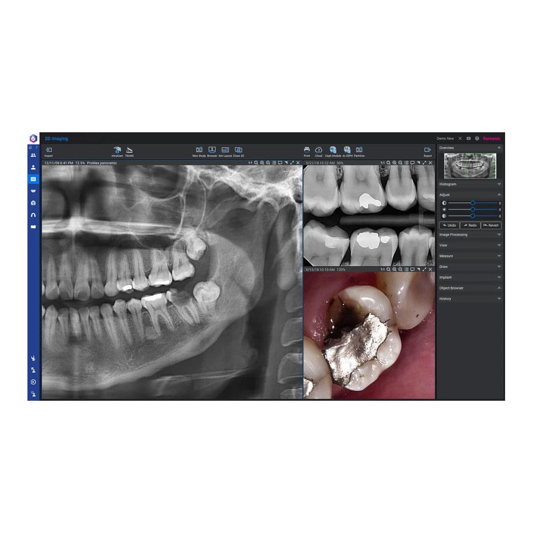 Analysis software - Romexis® - Planmeca - diagnostic / medical / dental