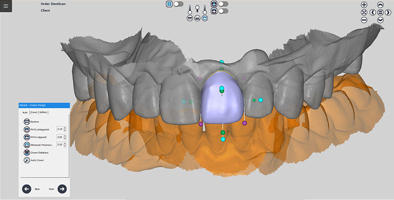 Design software - RAYDENT designer - Ray - dental / for tablet PC