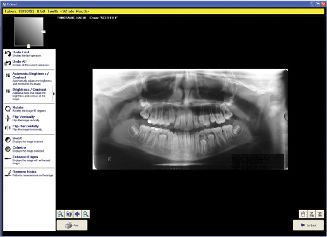 Data management software - Dr. Suni - Suni Medical Imaging - for dental ...