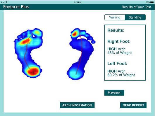 Podiatry software - Footprint Plus™ - Tekscan - data management ...
