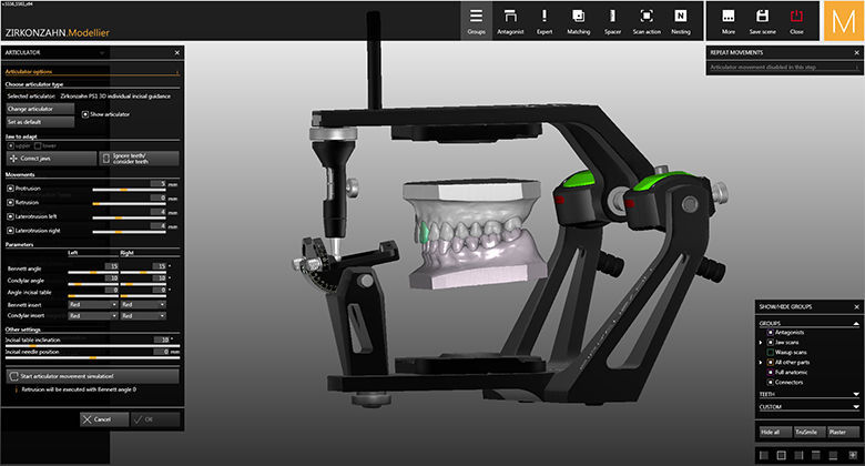 Virtual articulator - SY0410 - Zirkonzahn - Videos