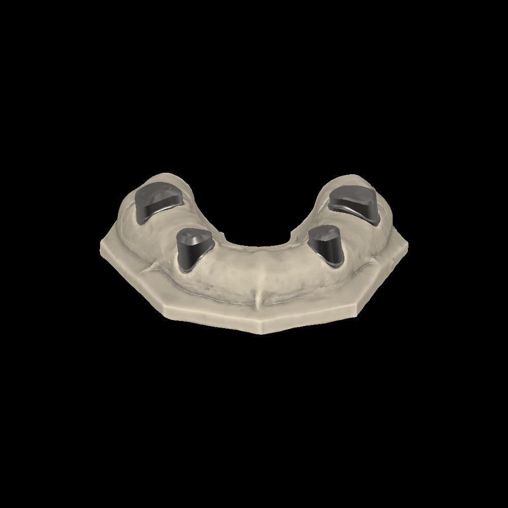 CAD software module - Telescopic crowns - Zirkonzahn - for dental ...