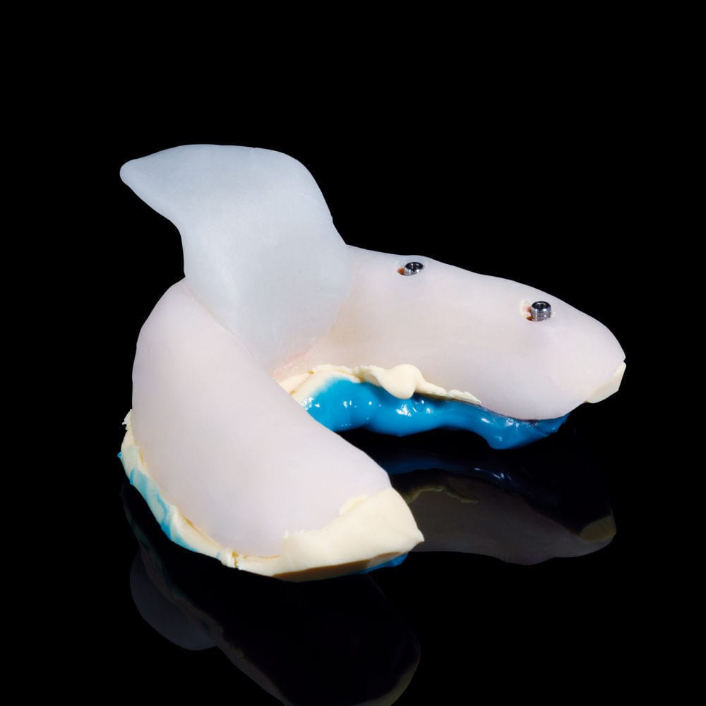 Impression coping - Zirkonzahn