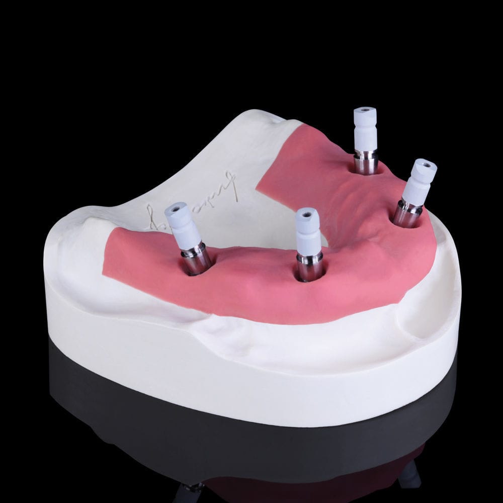 Intraoral scanbody - White Metal Scanmarker - Zirkonzahn - metal / white