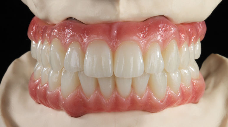 Resin dental material - Prime - Zirkonzahn - for dental restorations ...