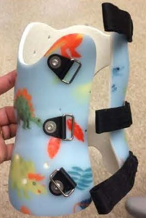 Thoraco-lumbo-sacral support corset - Boston Orthotics + Prosthetics ...