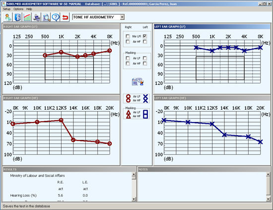 Audiometry software - W50 - SIBELMED