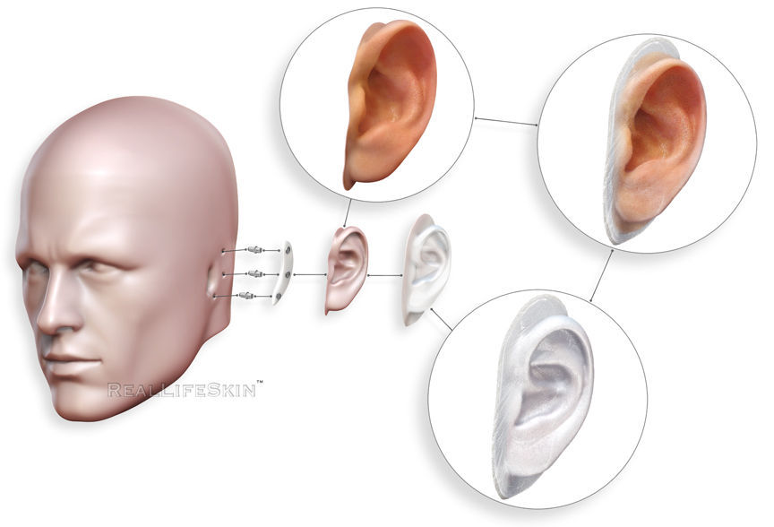 Auricular cosmetic prosthesis - RealLifeSkin™ - RealLifeSkin - adult