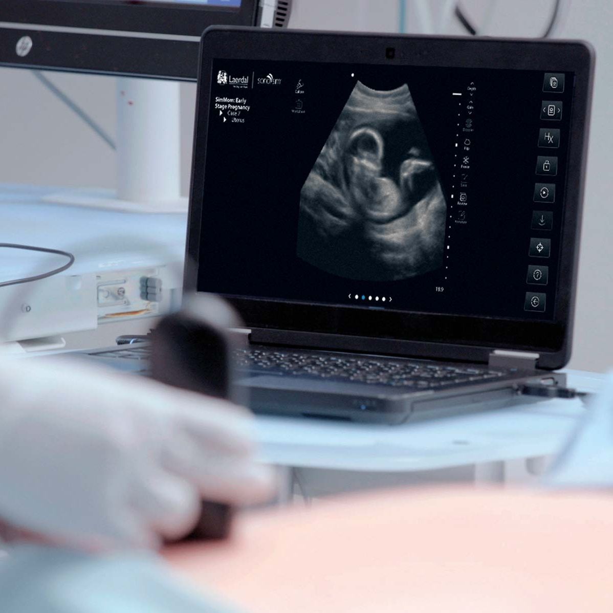 Training simulator - SonoSim® - Laerdal Medical - for ultrasound ...