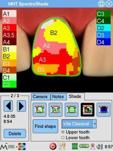 Dental colorimeter - SpectroShade™ Micro - MHT Optic Research - digital