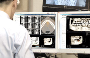 Dental implant simulation software - Xelis - Infinitt Healthcare - for ...