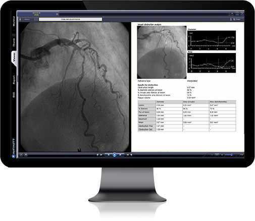Medical imaging PACS - Infinitt Healthcare - web-based