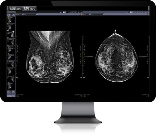 Diagnostic medical software - Infinitt Healthcare - CAD / medical / for ...