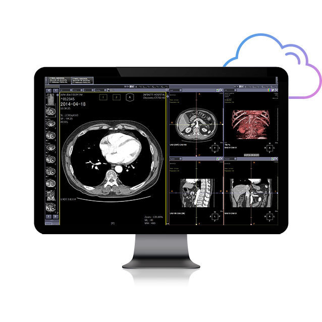 Web-based PACS - Smart Net - Infinitt Healthcare - medical
