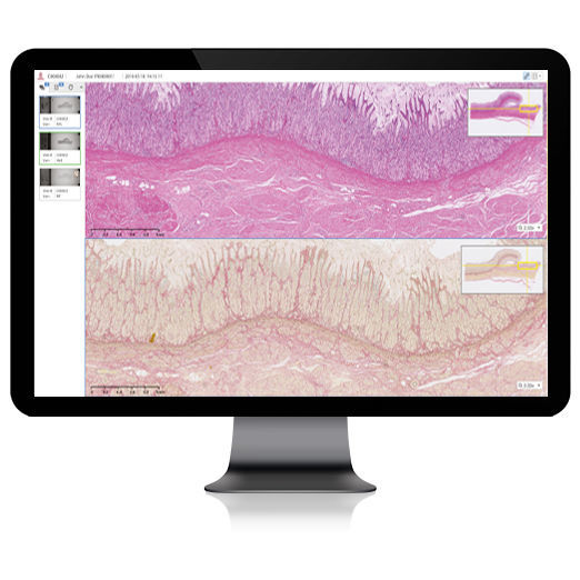 Diagnostic software - Infinitt Healthcare - measurement / sharing ...