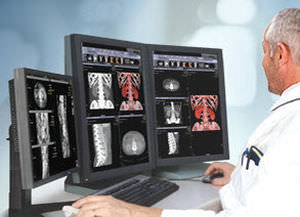Medical imaging PACS - INFINITT PACS - Infinitt Healthcare - web-based