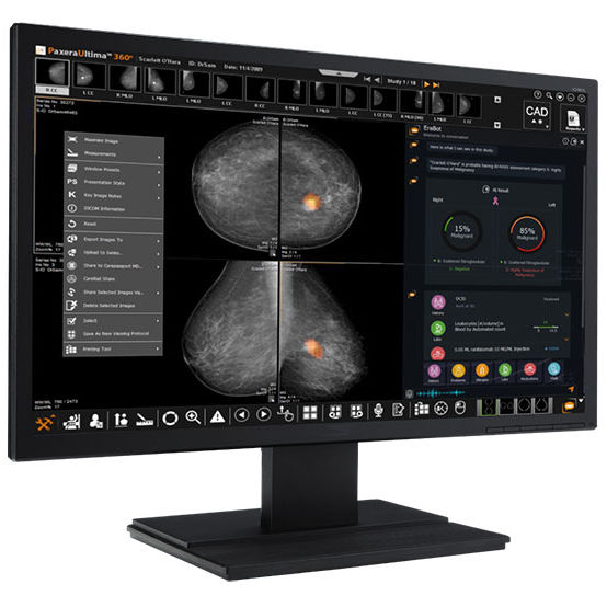 Visualization software - Paxera AI - PaxeraHealth Corp - diagnostic ...