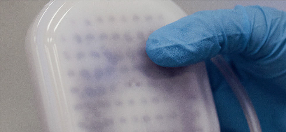 Blood filter - IMUGARD® III - Terumo BCT - for blood bags