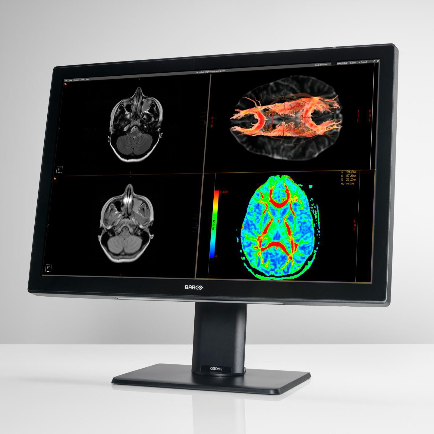 Diagnostic display - MDCC-6530 - Barco - high-definition / 30.4in / LCD