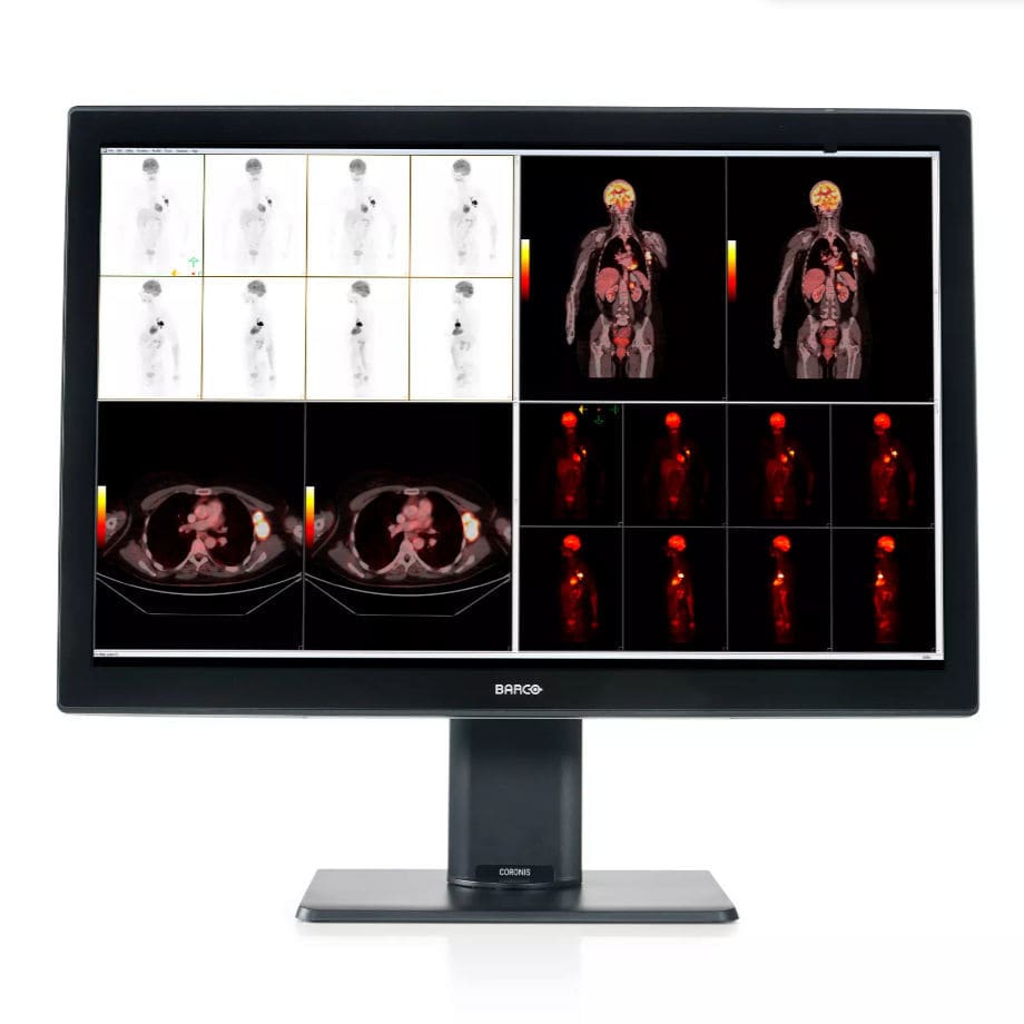 Diagnostic display - MDCC-6530 - Barco - high-definition / 30.4in / LCD