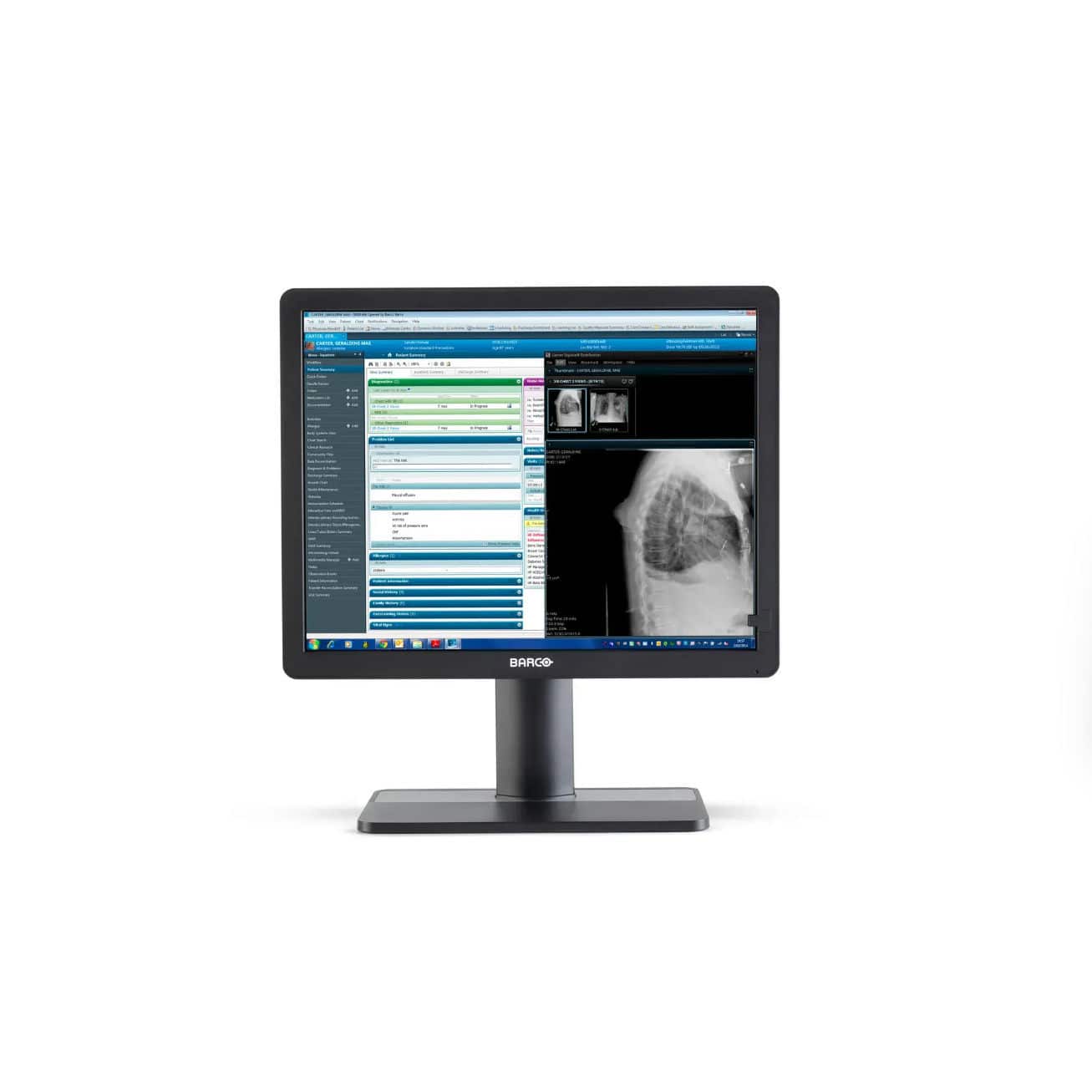 Radiology display - MDRC‑2421 - Barco - 21in / 4:3 / HDMI