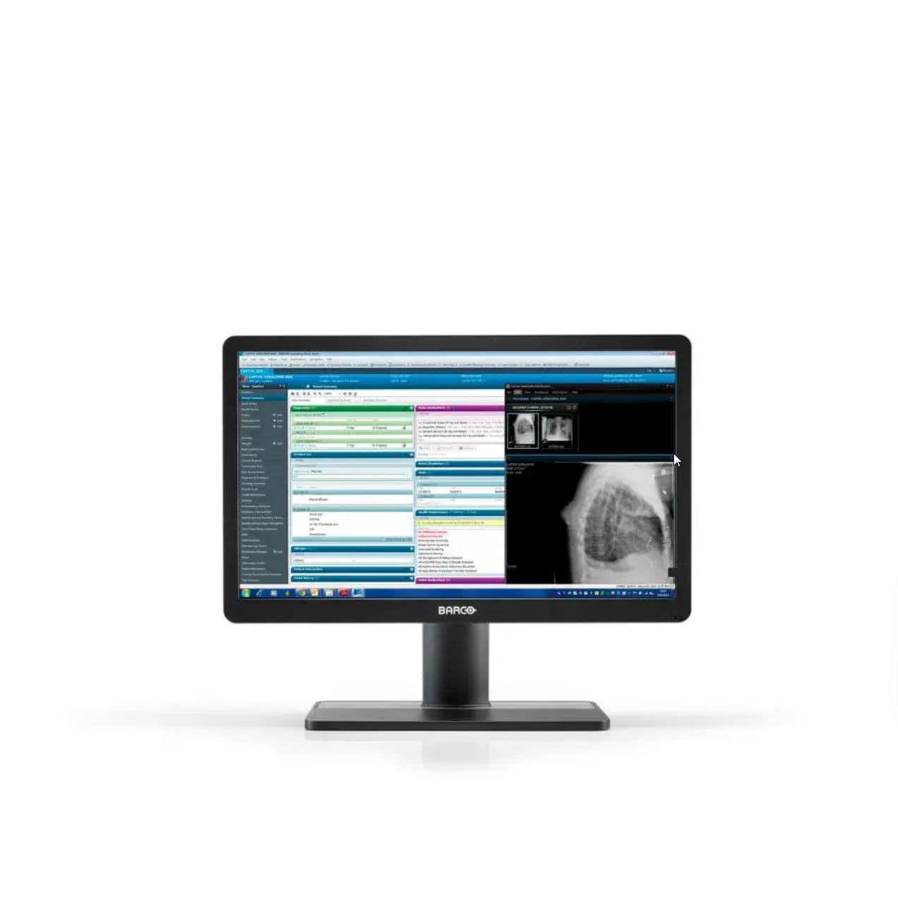 Radiology display - MDRC‑2422 - Barco - 1920 x 1080 / 22" / 16:9