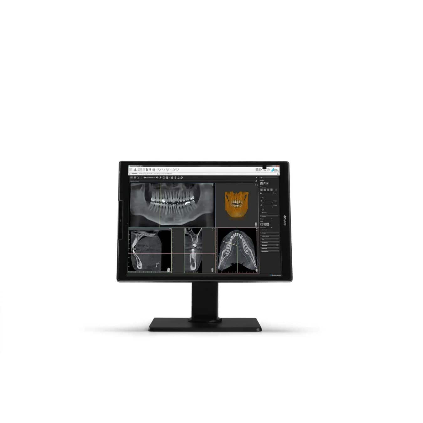 Diagnostic display - MDNC‑3521 DE - Barco - dental / 21.3in / 4:3