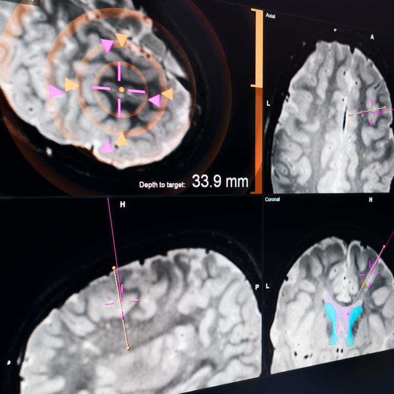 Control software - EM - Brainlab - calibration / surgical navigation ...