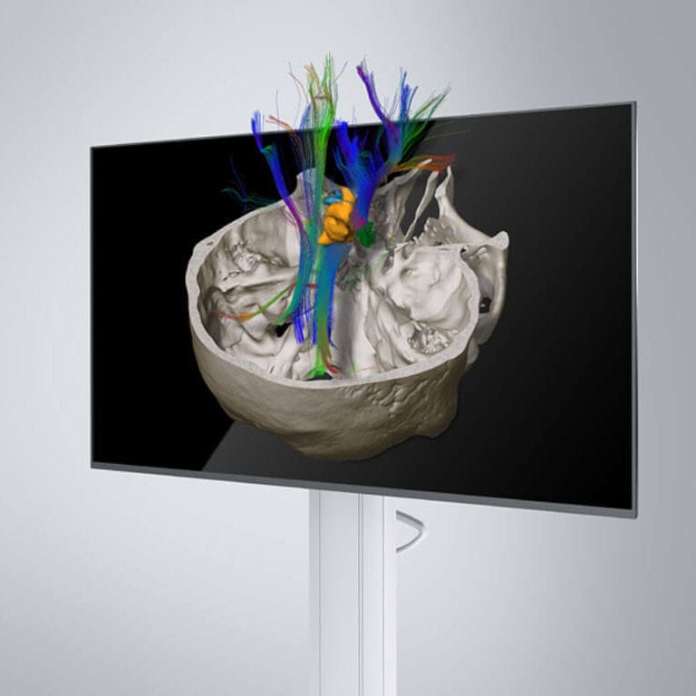 DICOM viewing software module - Brainlab - planning / contour detection ...