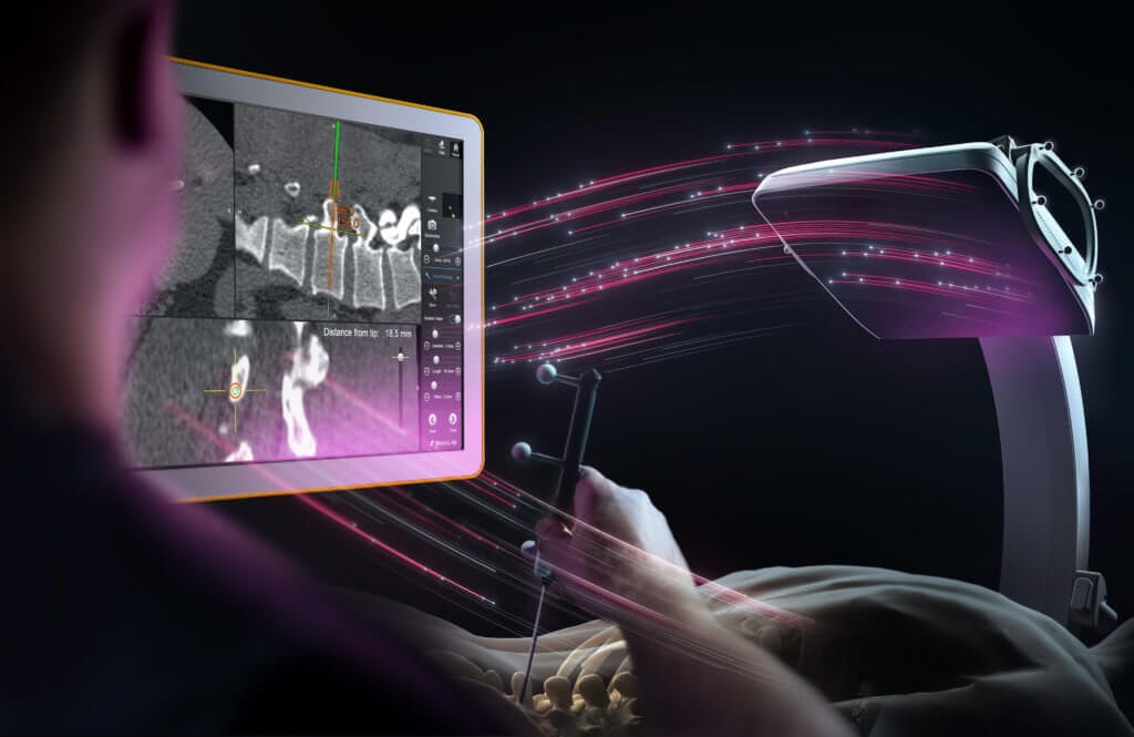 Tracking software - Brainlab - navigation / medical / anatomy