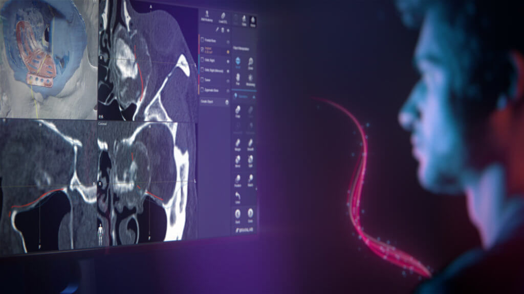 Planning software - Brainlab - medical / cranial surgery / surgery
