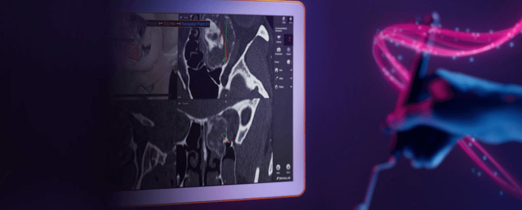 Navigation software - Brainlab - verification / medical / CT