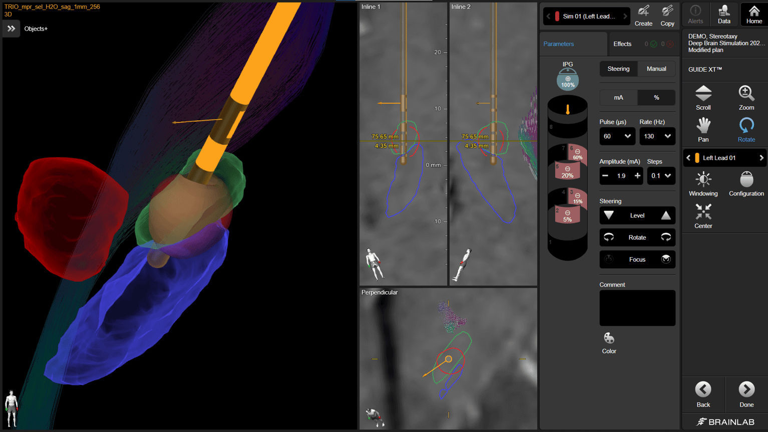 Analysis software - Brainlab - visualization / treatment / planning