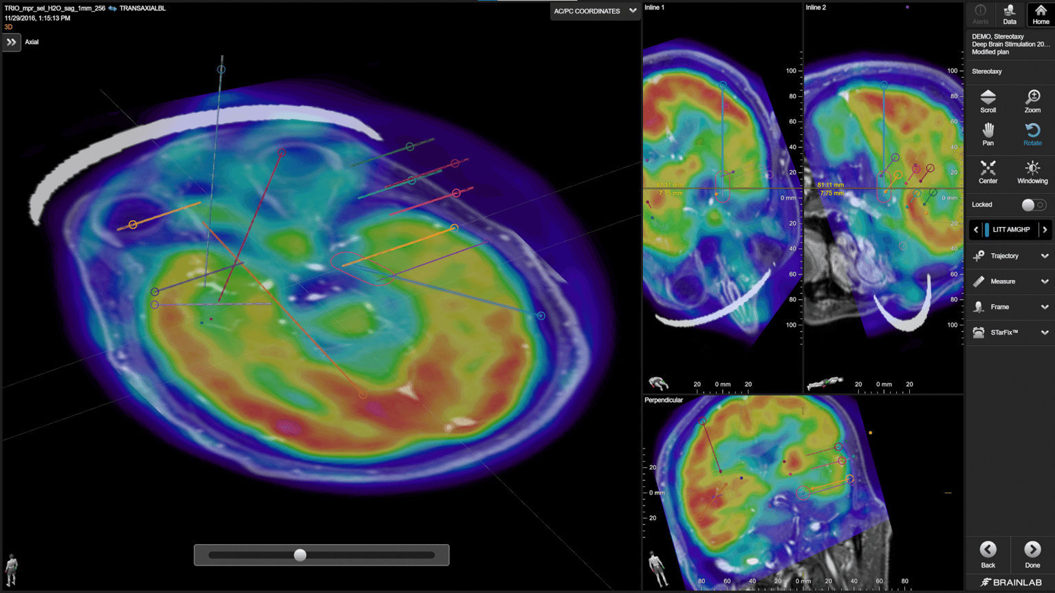 Visualization software - Brainlab - viewer / diagnostic / treatment