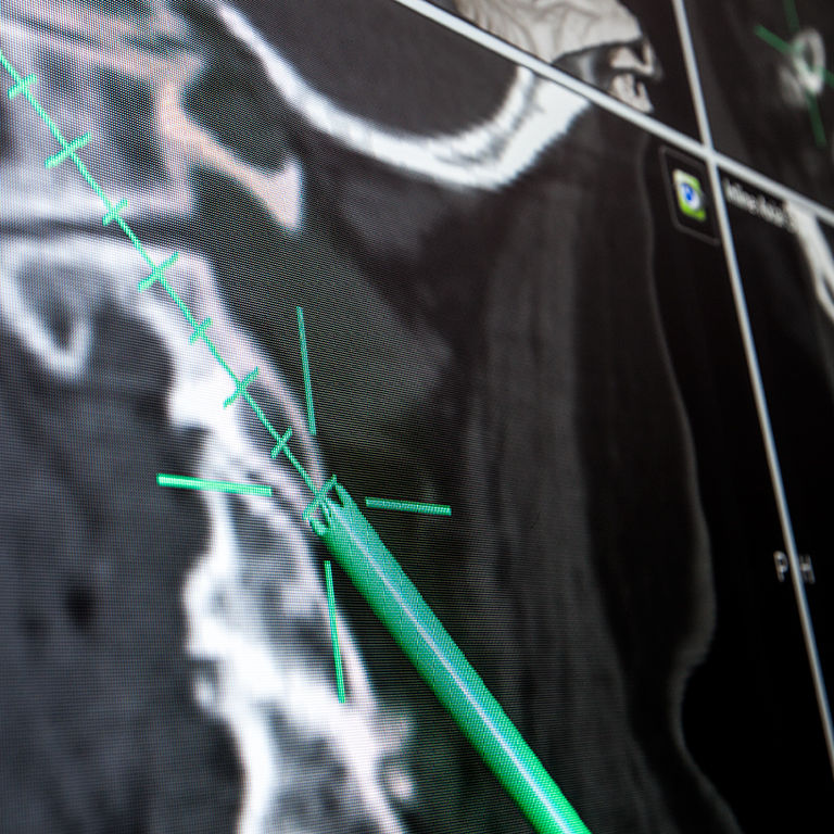 Surgical navigation software - Brainlab - planning / medical / hospital