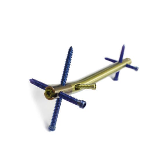 Tibial intramedullary nail - CHARFIX2 - ChM - ankle / distal fixation ...