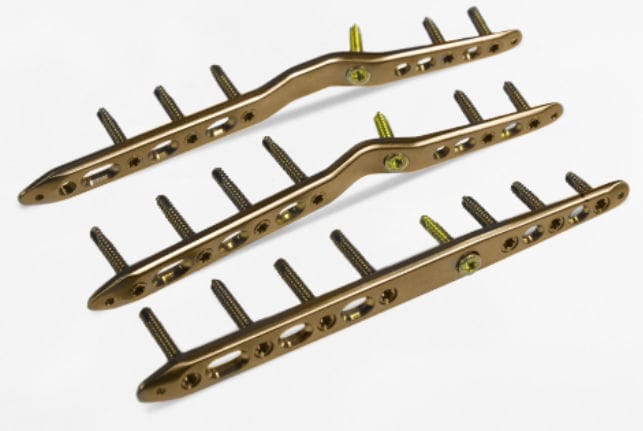 Wrist arthrodesis plate - 3.703 series - ChM - dorsal / locking / titanium