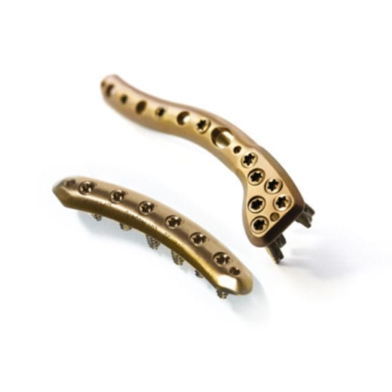 Clavicle compression plate - 3.402 series - ChM - distal / locking ...